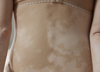 RSL Labs ~ euSKIN products ~ Dermaceutical solutions